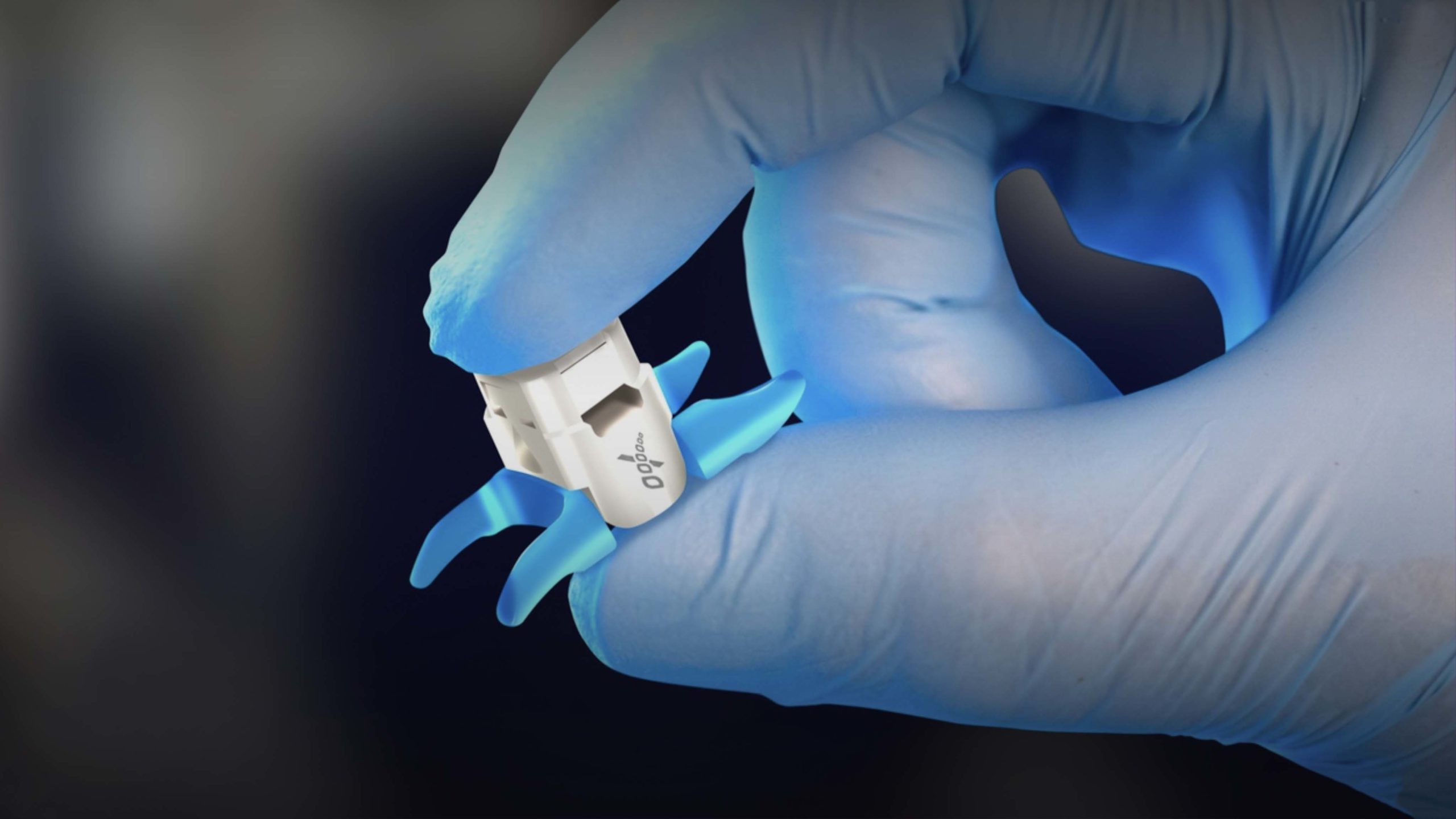 Vertiflex Procedure Des Moines, Iowa | Central States Pain Clinic